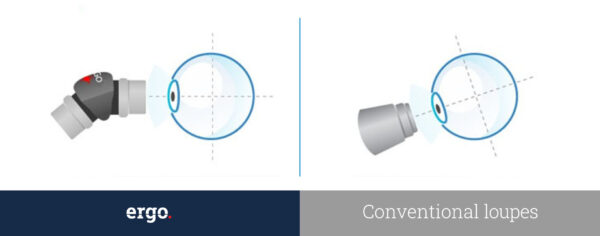 Official Ergo Loupes Showcase Page – ADMETEC