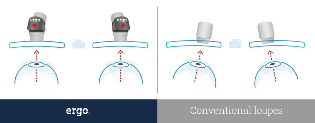 Ergo Loupes – the future of dental ergonomics is now | ADMETEC