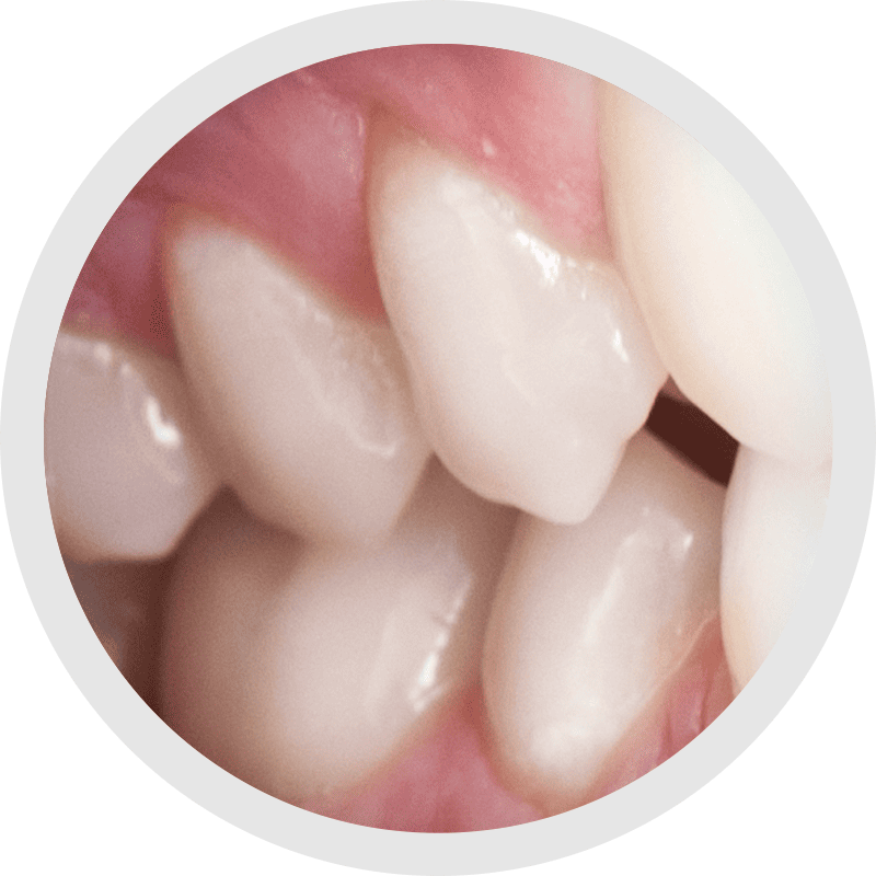 Ergo V™ Loupes: Variable Magnification Loupes | Admetec