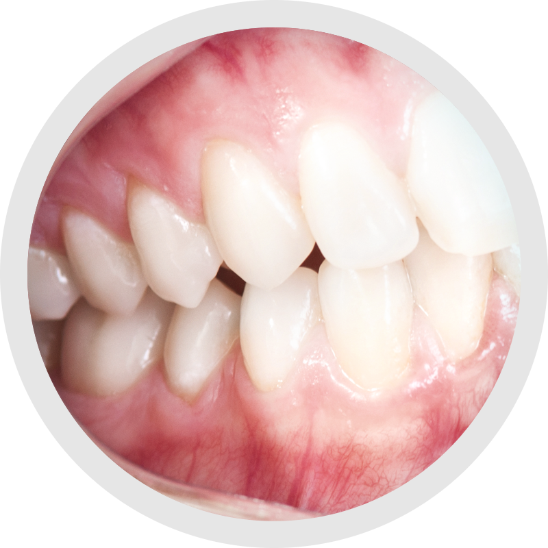 Ergo V™ Loupes: Variable Magnification Loupes | Admetec